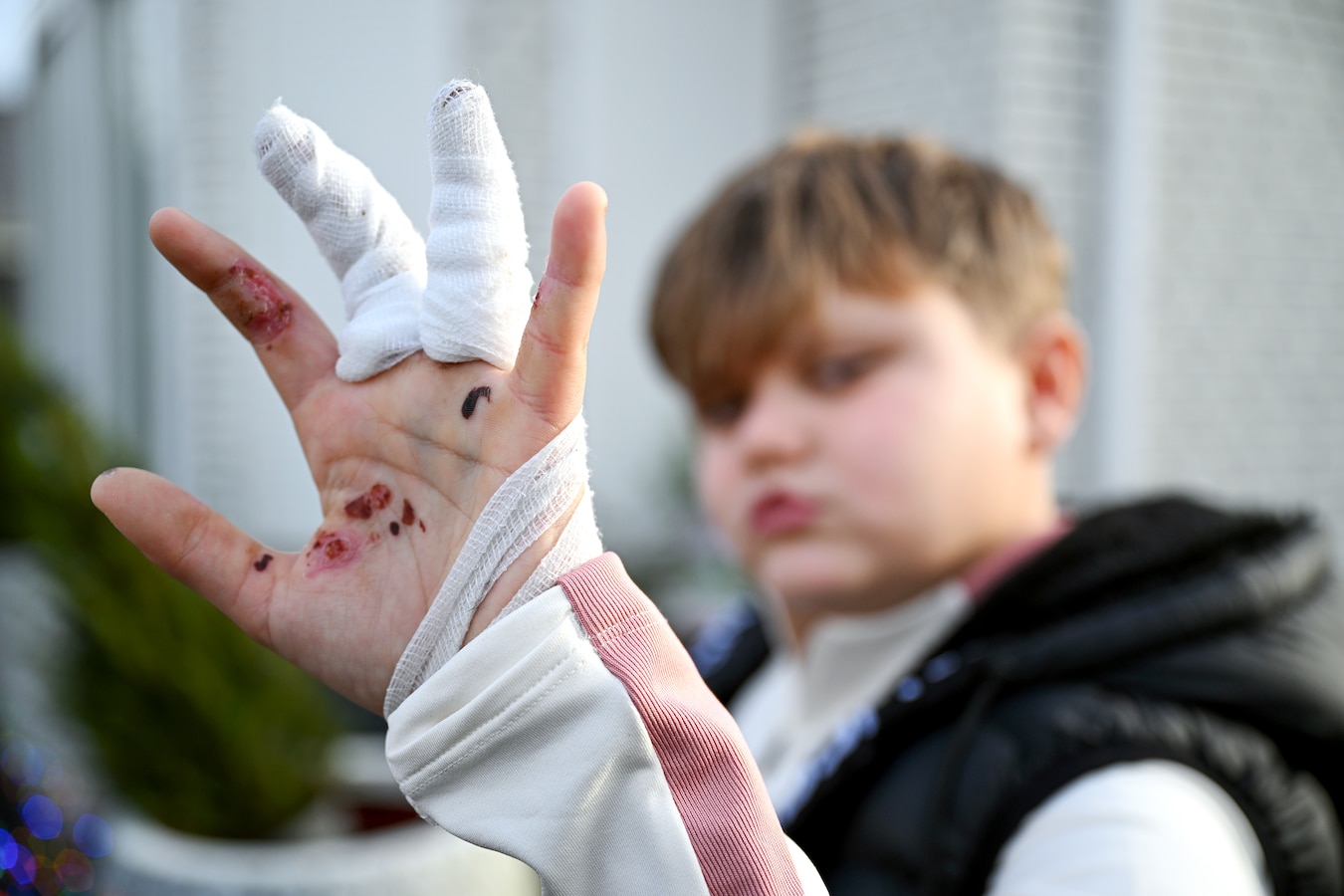Pablo (12) mag blij zijn dat hij al zijn vingers nog heeft en ...