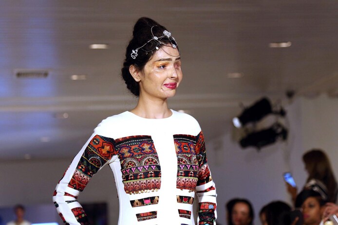 Overlever zuuraanval op de catwalk tijdens Fashion Week | Nieuws | bd.nl