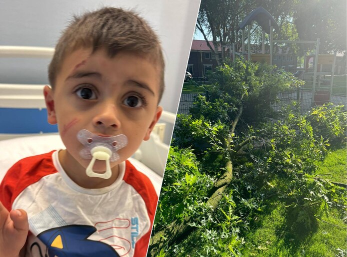 Tilburgs jongetje (3) belandt onder grote boomtak in speeltuin voor zijn huis: ‘Gemeente kan ...